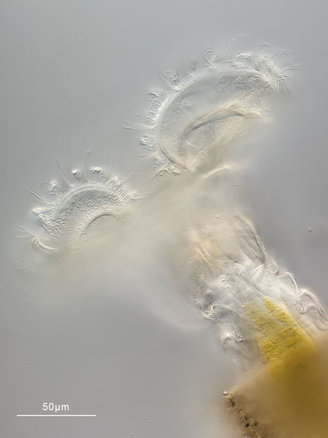 明石・神戸の虫 ときどきプランクトン2: マルサヤワムシ科ワツミワムシ属の一種（Limnias sp.）