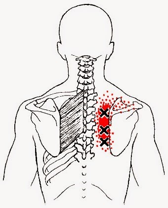 Body matters: DIY Acupressure | Shoulder blade | Rhomboid pain relief