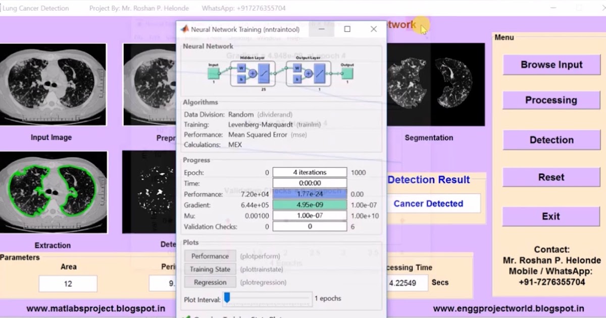 Lung Cancer Detection Using Neural Network Matlab Project Source Code ~ Matlab Project Codes