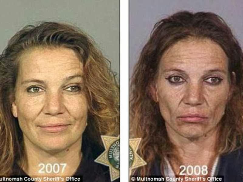 De Drogas Ilegales: Efectos visibles de las drogas en el rostro