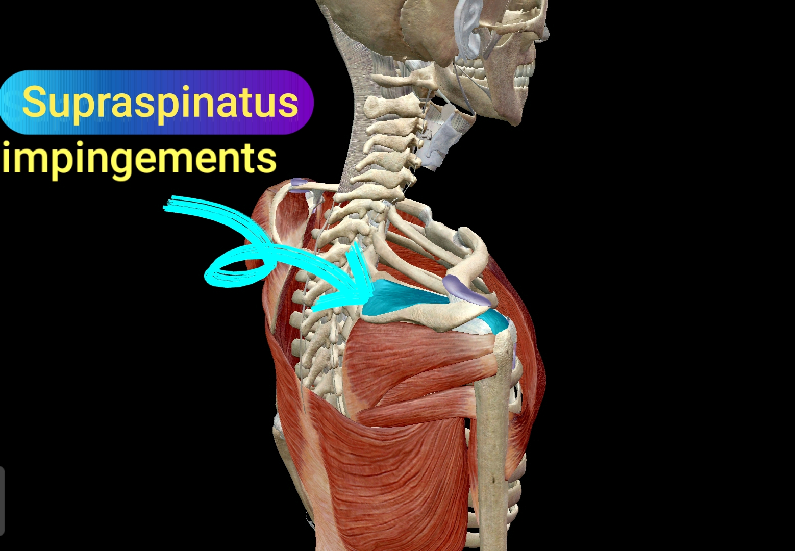 Shoulder impingement | special test