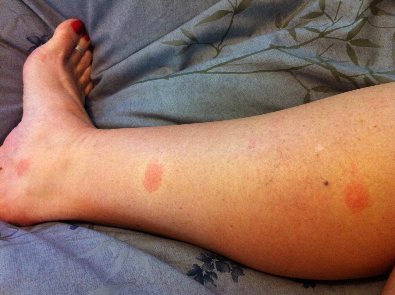 Keep Moving Forward: Those Damn Geese