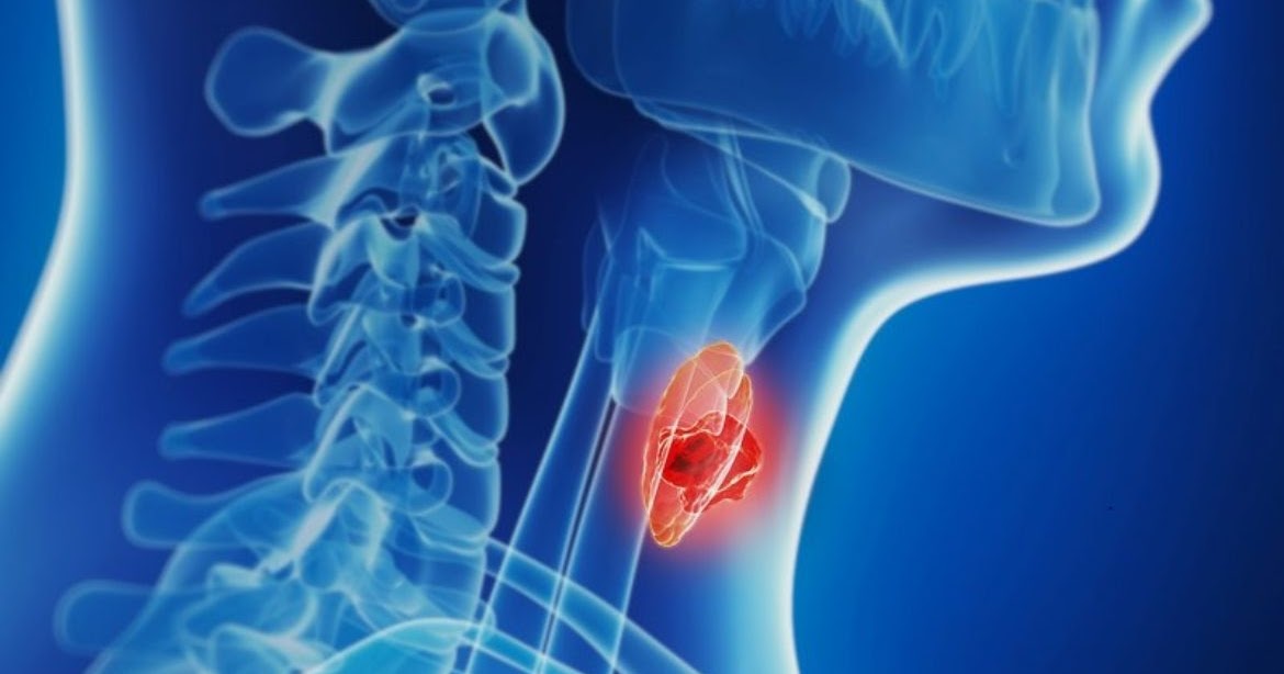 WHAT IS LYMPHOMA : INTRODUCTION