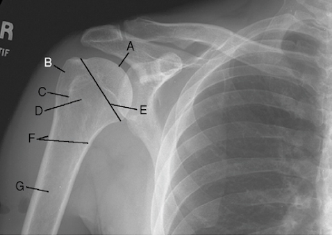 CONTEXTUALIZACION ANATOMICA: humero