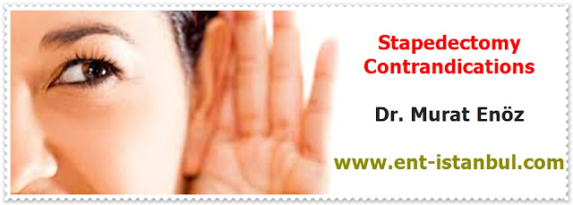 Stapedectomy Operation in Istanbul