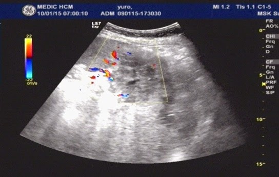 Spleen Us : Spleen Histology Osmosis / Overview of the spleen anatomy ...