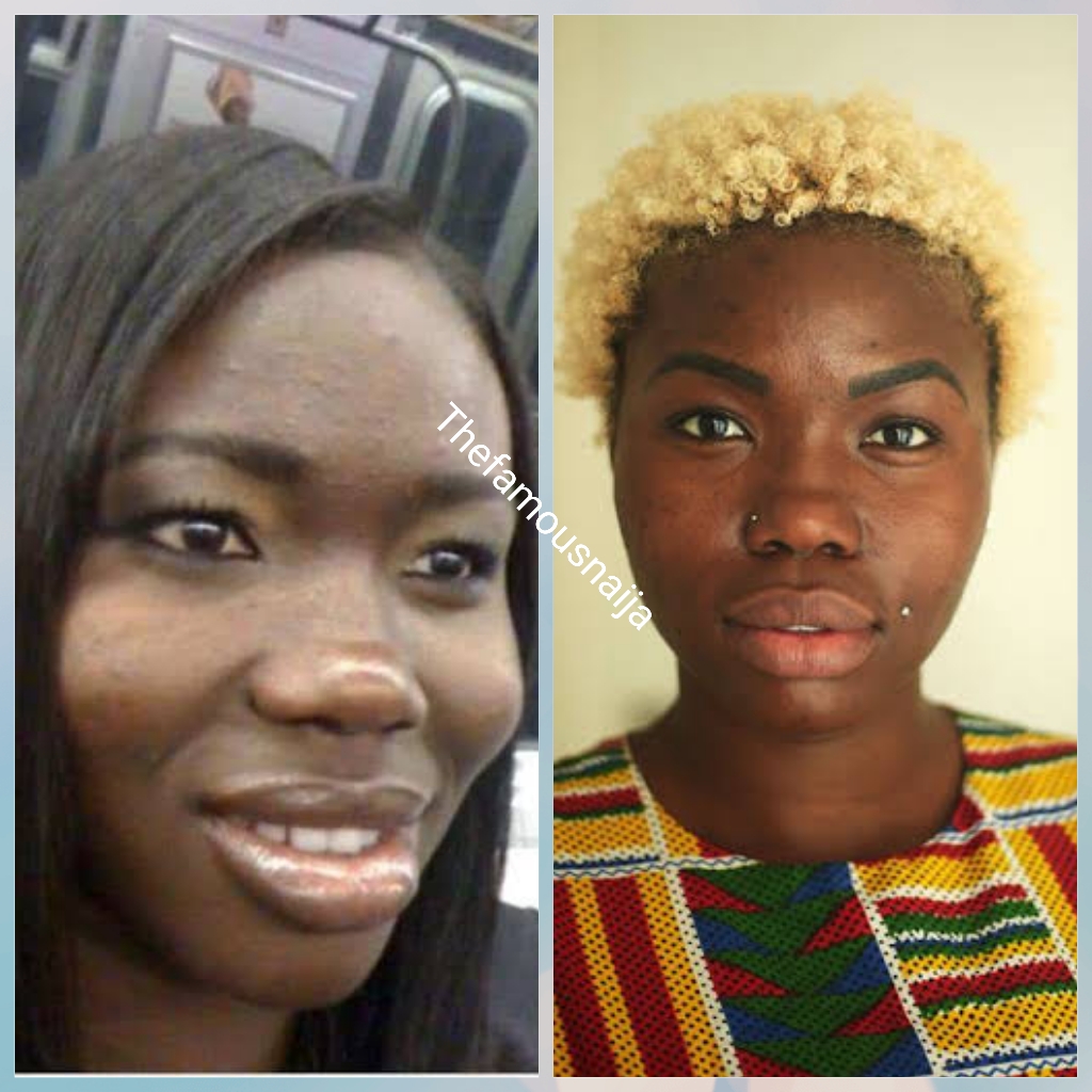 Photo of Maria Mobil before surgery