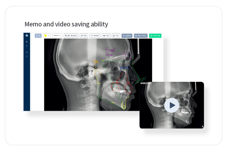 WEBCEPH, why do you need it?