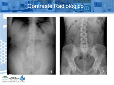 UN ESPACIO PARA LA RADIOLOGÍA.: CONTRASTE DE LA PELÍCULA.