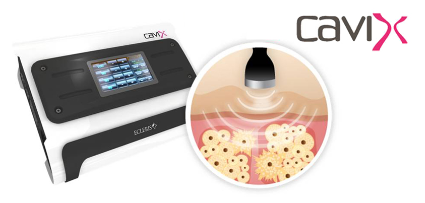 Comunidad Vitacare: CAVIX - Protocolo general