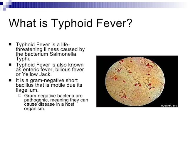 What is Typhoid Fever? Symptoms, Causes, Myths ~ Health