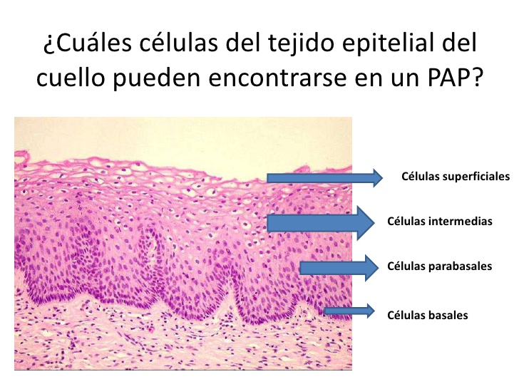 Citología Exfoliativa Mérida: Células normales en una prueba de ...
