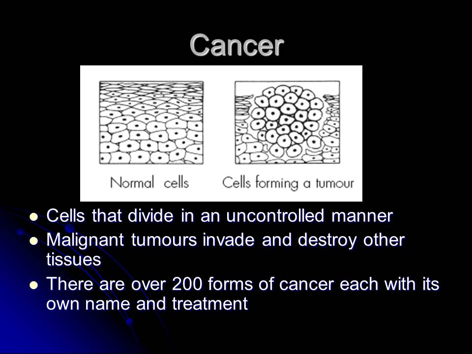 GCSE Physics: Y11 Module 11 & Triple - Cancer Treatment