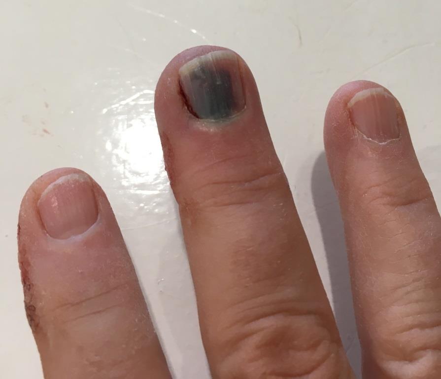 furtling through August