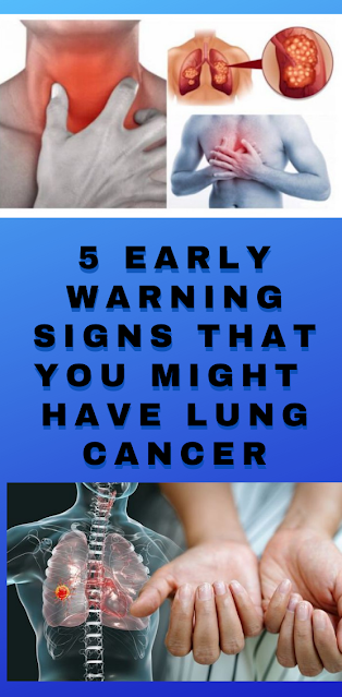 5 Early Warning Signs That You Might Have Lung Cancer - medicine health ...