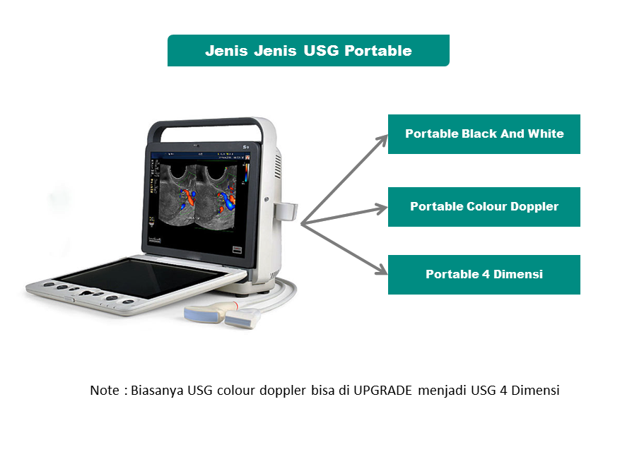 Jenis Mesin Ultrasonografi (USG)