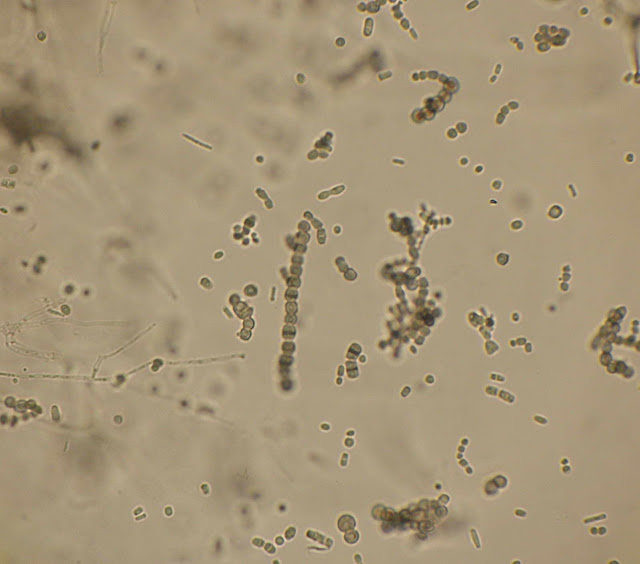 ATLAS MICOLOGIA: SCYTALIDIUM DIMIDIATUM (Neoscytalidium dimidiatum)