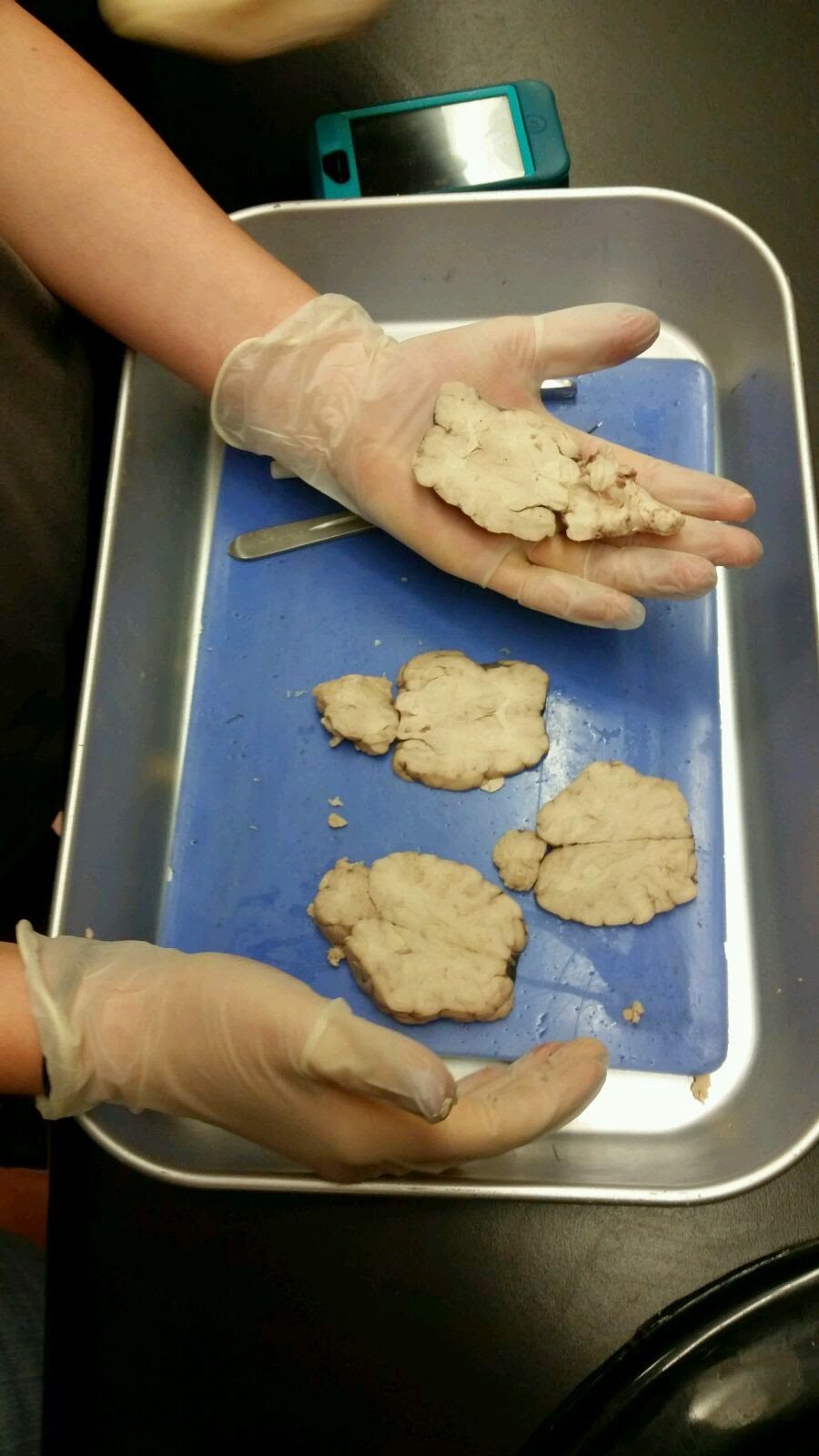 Anatomy and Physiology : Sheep Brain Dissection