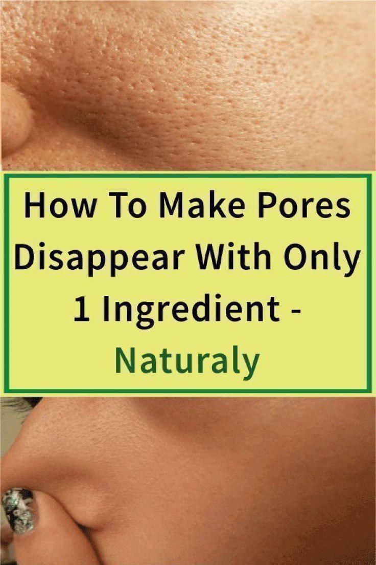 How To Make Pores Disappear Naturally Using Only 1 Ingredient - Healthy ...