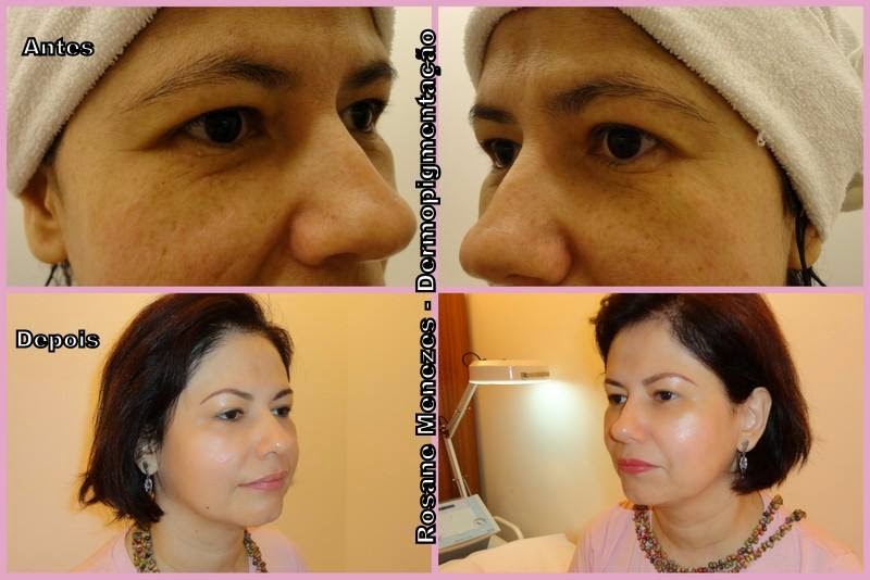 Rosane Menezes, Saúde e beleza.