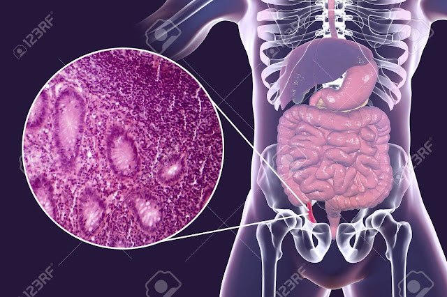 Scientia potentia est: Human Appendix could have an important ...