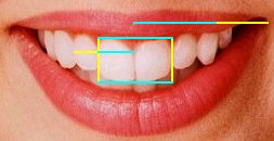 A Model's Secrets: The Perfect Face - Golden Ratio Beauty Calculator