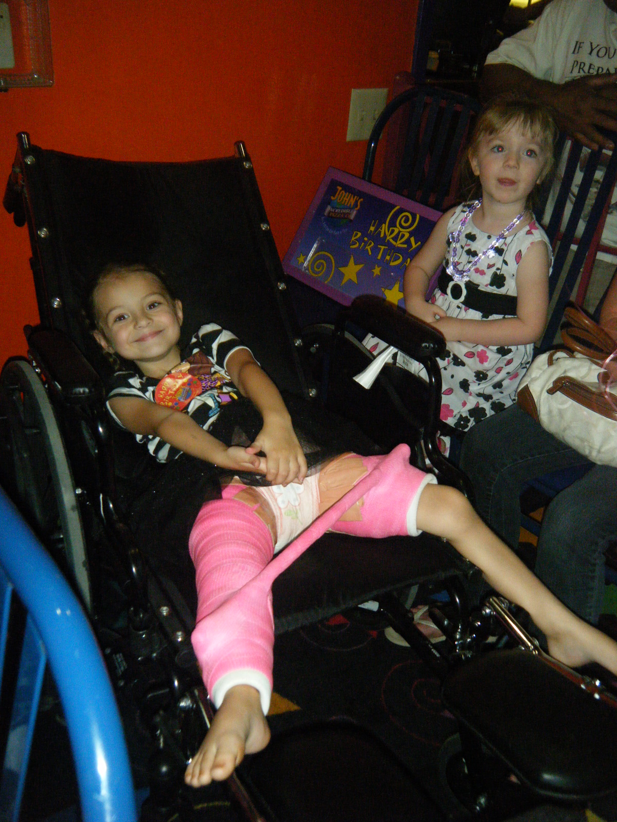 Makani's Shianne Robertson with Fibular Hemimelia: Fracture & casting