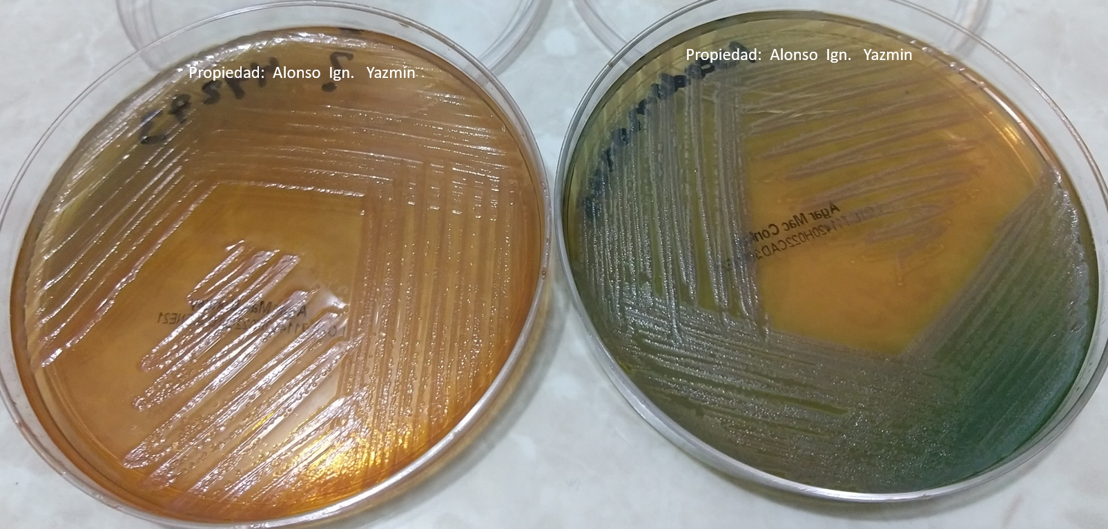 Pseudomonas Aeruginosa On Macconkey Agar