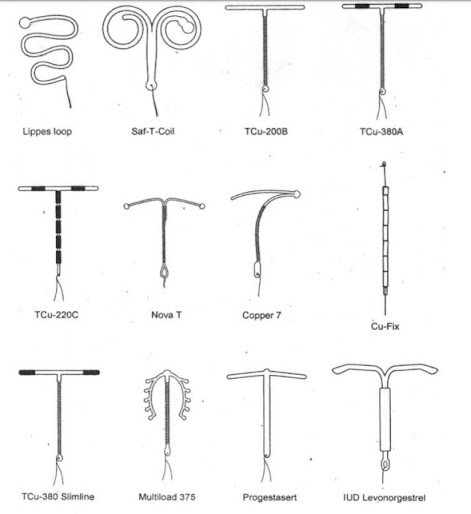IUD/SPIRAL/ALAT KONTRASEPSI DALAM RAHIM (AKDR)