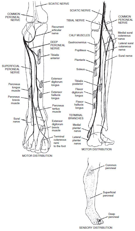 Common Fibular Nerve Injury Case File