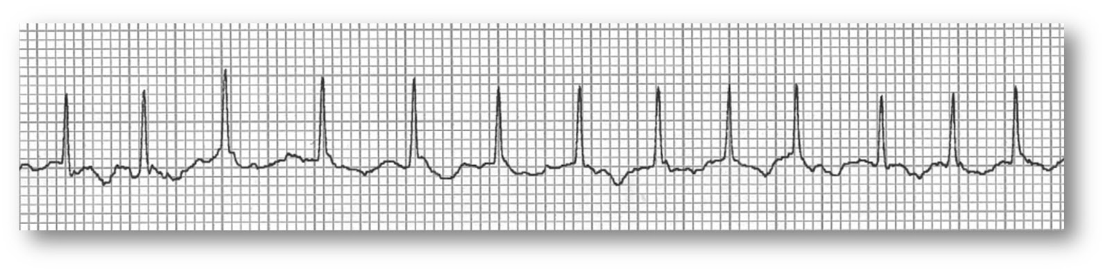 Andrew R. Houghton: What do we mean by 'rate control' in AF?