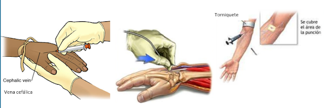 PRIMEROS AUXILIOS Y BÁSICO EN ENFERMERÍA: VENOCLISIS