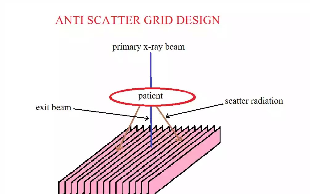 Anti scatter grid - paramedical guru
