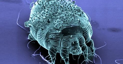 .: Cara Rawat Kudis Buta atau Scabies Dengan Semulajadi