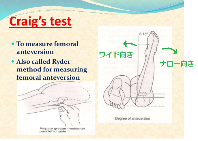 クレイグテスト – 足関節 前方引き出しテスト – VISHUJI