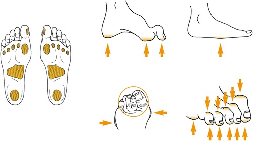 How to Avoid Diabetic Septic Foot Problems - Just Call Me, Adi