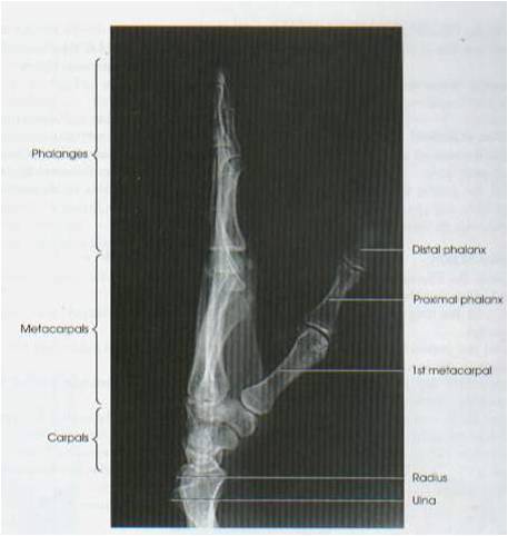 Catatan Ku: Teknik Radiografi Manus