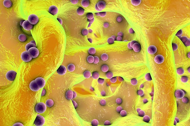 BARODA MEDICAL COLLEGE RADIOLOGY