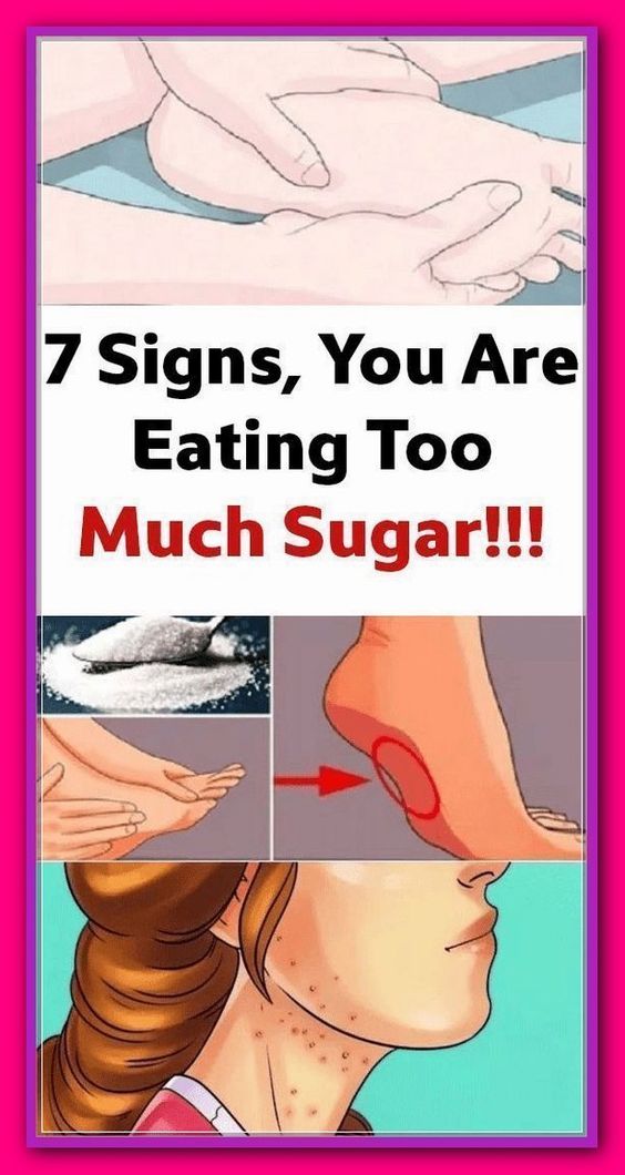 7 Signs You Are Eating Too Much Sugar - healhty and tips