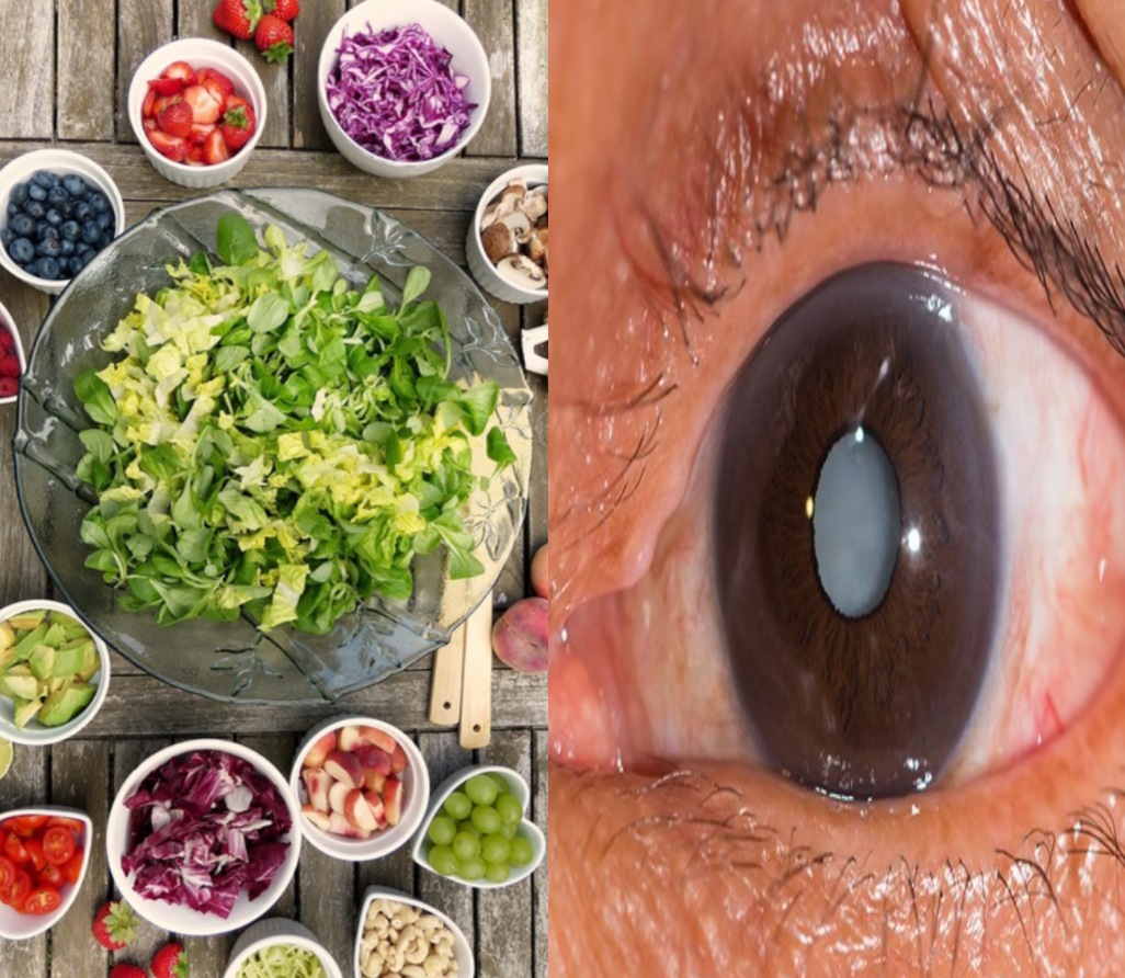 7 ingrédients naturels pour prévenir le risque de cataracte