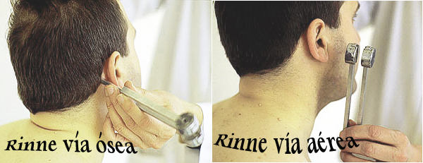 el blog del otorrino: Pruebas acumétricas- Rinne