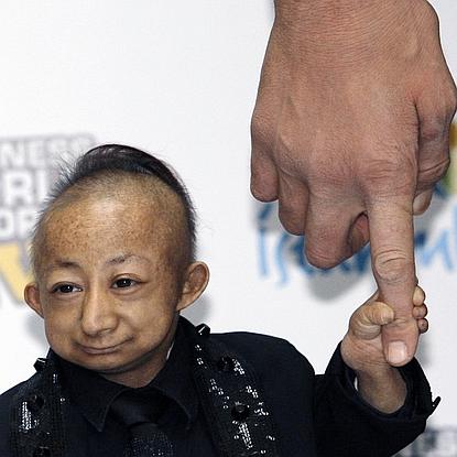 Sharing Pictures: Smallest Man In World From Turkey
