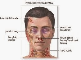 ryostha lopheforever: TRAUMA CAPITIS-GADAR