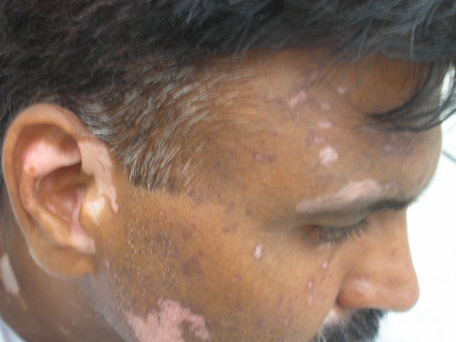 Know the Diseases