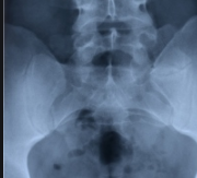 ANATOMÍA RADIOLOGÍCA