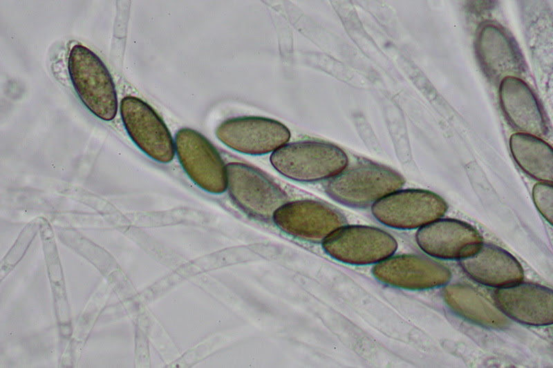 El mundo microscópico de los hongos: Ascomicetos