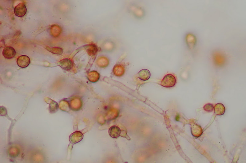 El mundo microscópico de los hongos: Gasteromicetos