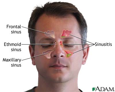 MEDICAL NURSING: Anatomy of Lung