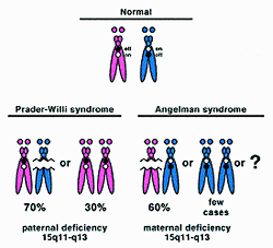 MY FRONTAL LOBE: The truth about Prader Willi Syndrome?