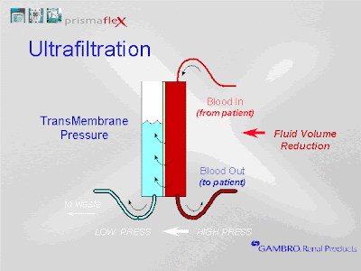 Hemodialysis Devices: Dialyzers